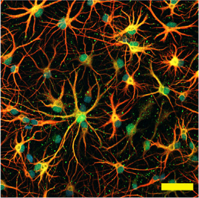 Don’t forget about the stars in your brain! | Lions Talk Science