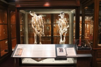 Morbid Museums: The Ethics of Displaying Human Remains | Lions Talk Science