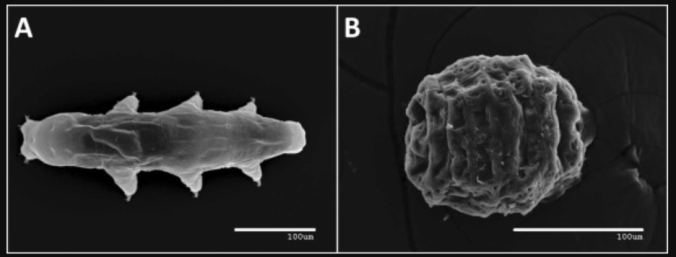 Five-Time Apocalypse Champion, the Tardigrade, Shares Its Secrets (And ...