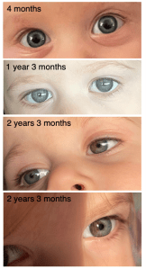 Heterochromia: Seeing the world through different colored eyes | Lions ...